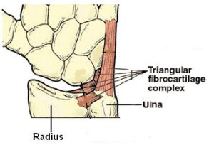 Triangular Fibrocartilaginous Complex – AMP Montana Athletic Medicine ...